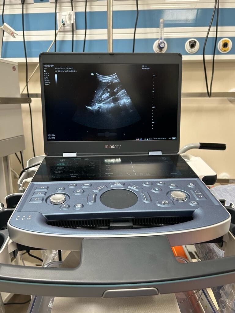 Ecograf nou la Spitalul Județean Sibiu, achiziționat în urma unei ...