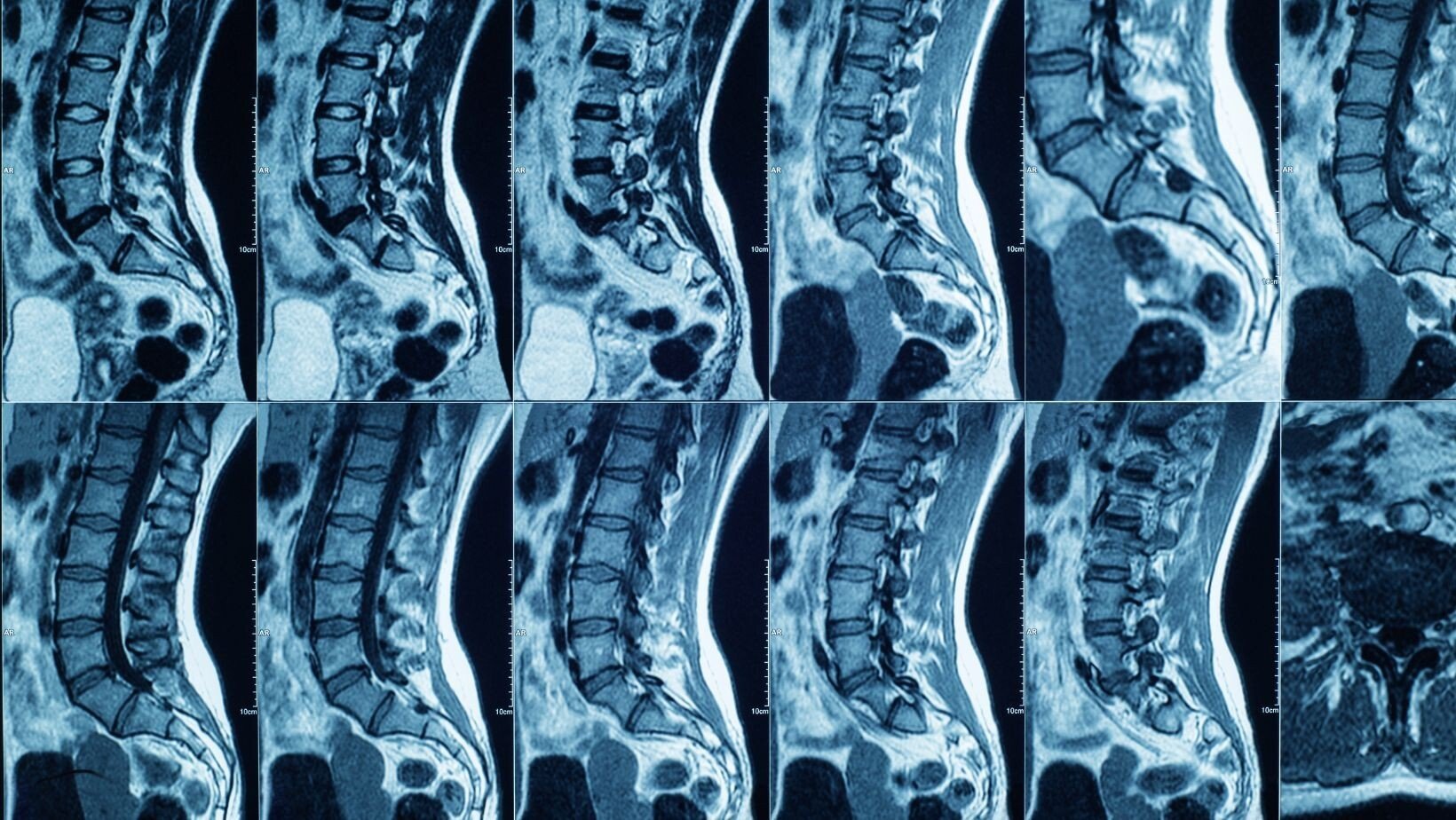 Află cauzele durerilor de spate - investighează corect pentru a trata ...